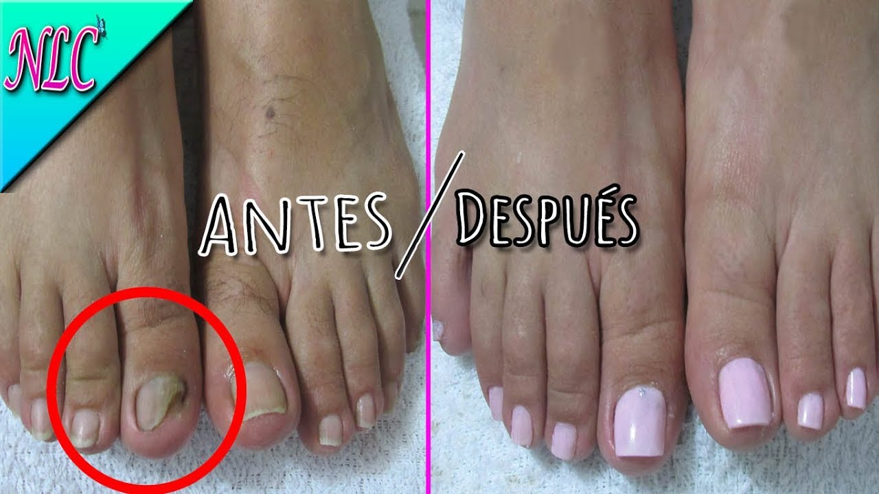 Cómo se pone el primer en las uñas - Belleza y Autoestima